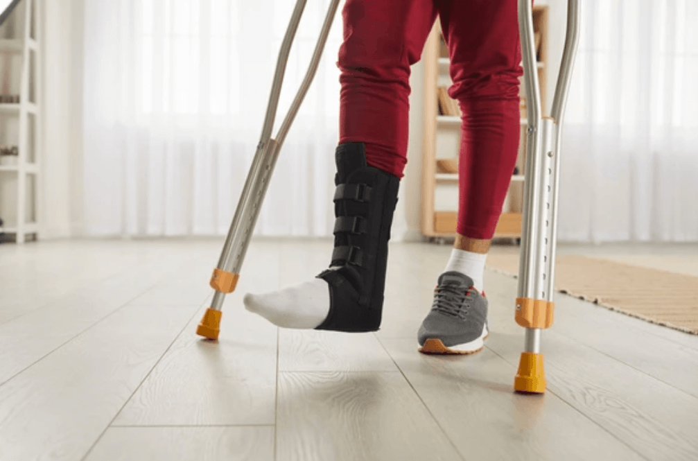 Fracture de la cheville - traitement, rééducation ᐅ CAREA ...