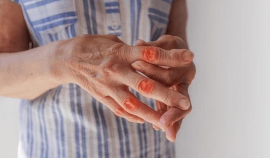 Arthrose des mains ᐅ CAREA Kinésithérapie Paris